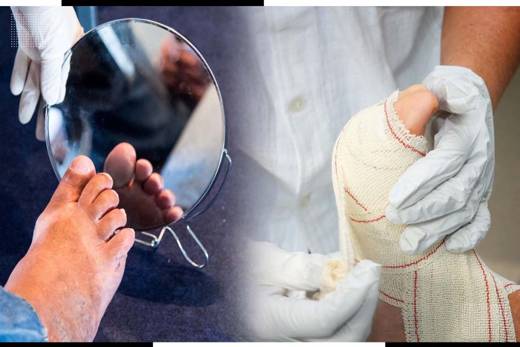 Foot Wound Riverside: A Guide to Treating and Healing Foot Injuries